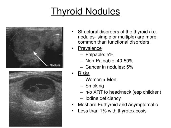 PPT - Thyroid Disease Facts PowerPoint Presentation - ID:67801