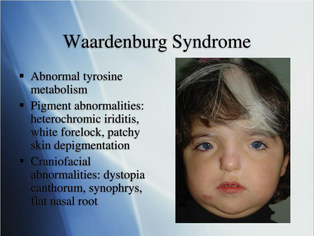 Ppt Congenital Hearing Loss Powerpoint Presentation Free Download