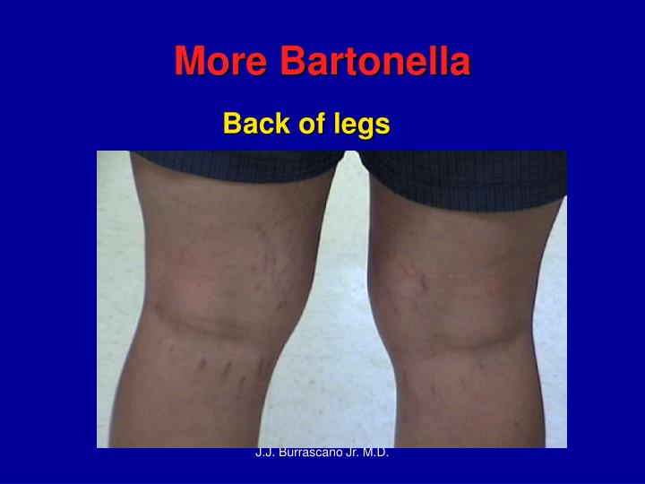 PPT - CASE HISTORIES: BARTONELLA-LIKE ORGANISMS PowerPoint Presentation ...