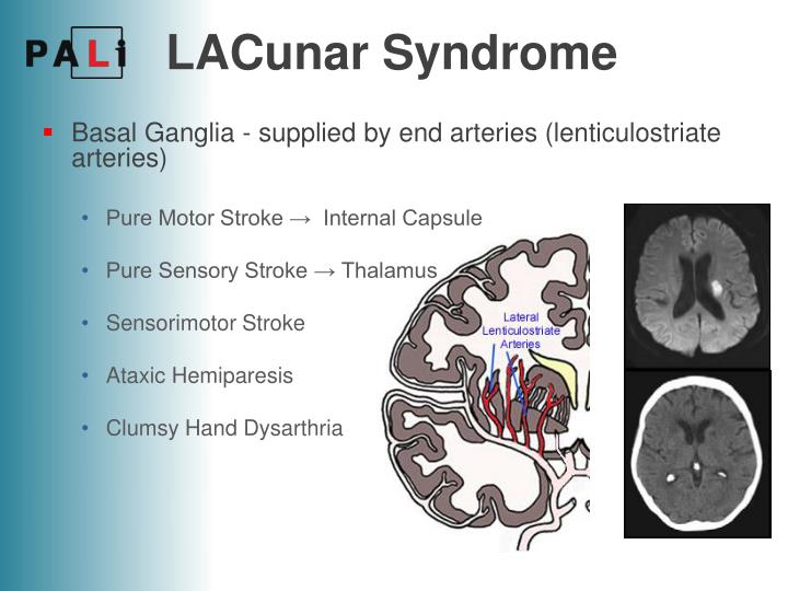 PPT - Neurology PowerPoint Presentation - ID:681193