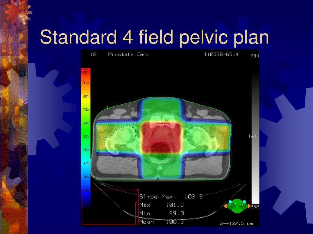 PPT - Radiation Oncology and Prostate Cancer Current Status and New ...