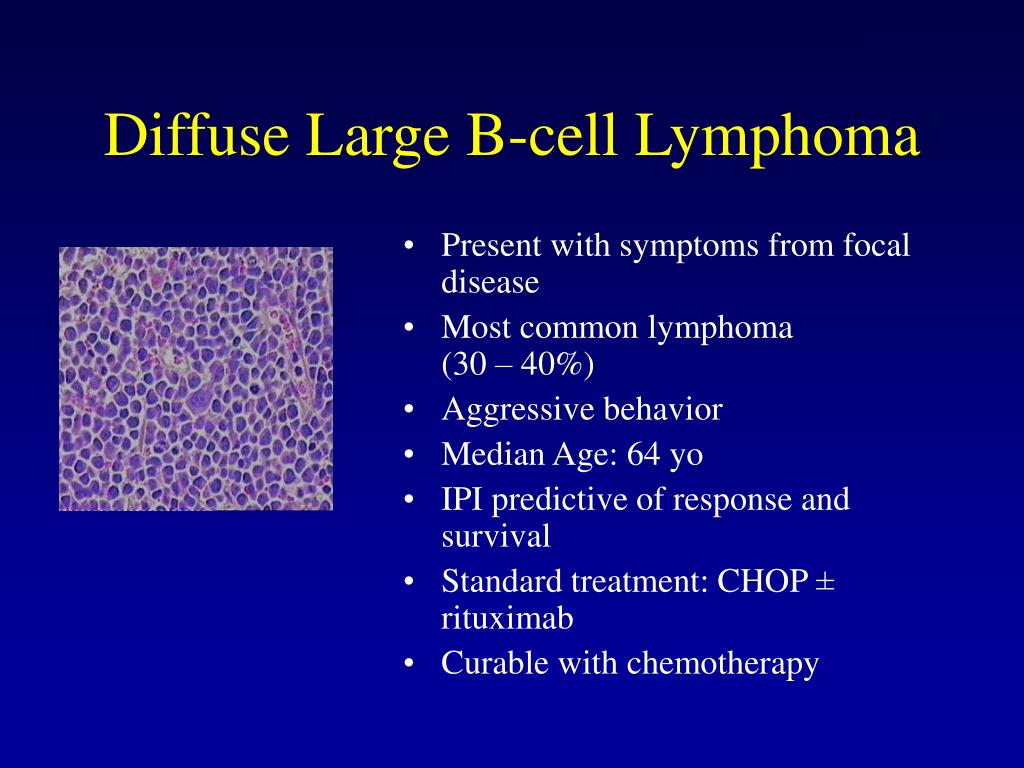 PPT - Lymphoma Presentation and Diagnosis PowerPoint Presentation, free ... PPT - Lymphoma Presentation and Diagnosis PowerPoint Presentation, free ...