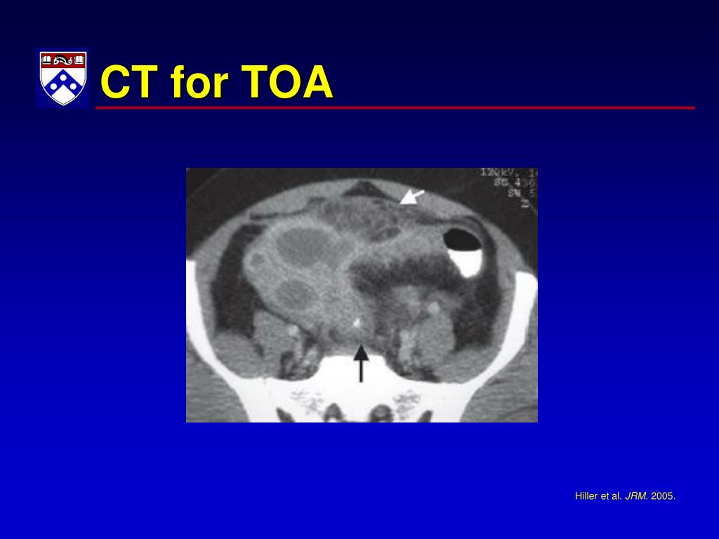 PPT - Discerning the Helpful From the Hedge: Imaging Tips for Abdominal ...
