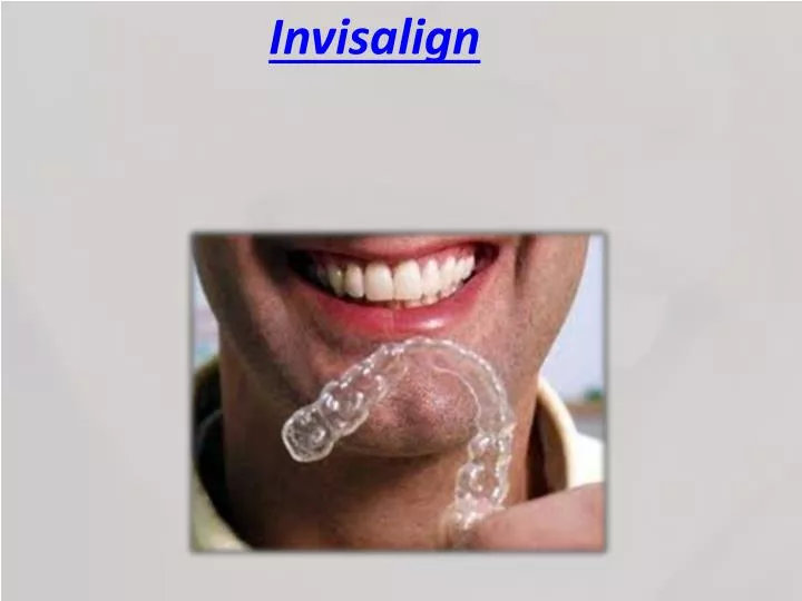 PPT - Invisalign PowerPoint Presentation, free download - ID:700001
