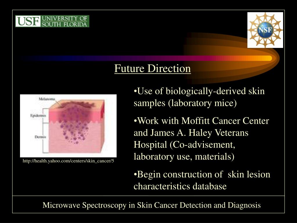 PPT - Microwave Spectroscopy in Skin Cancer Detection and Diagnosis ...