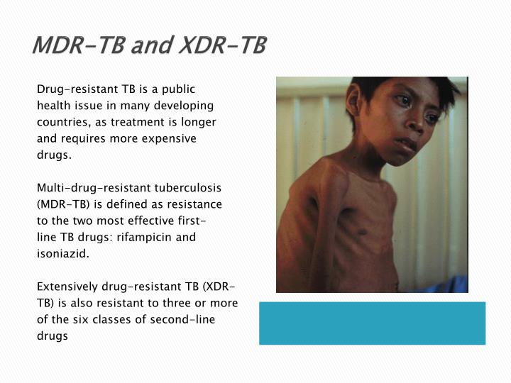 PPT - Diseases of the Respiratory System PowerPoint Presentation - ID ...