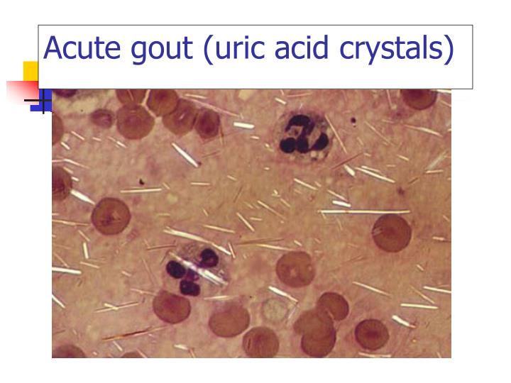 PPT - Synovial Fluid PowerPoint Presentation - ID:702385