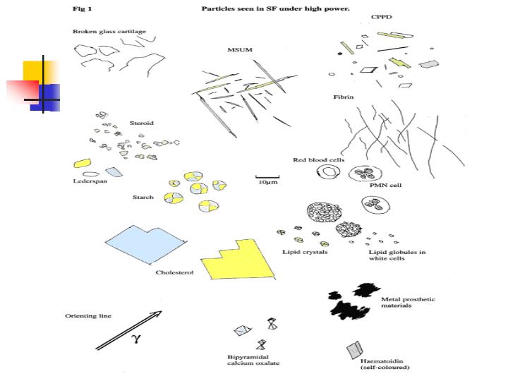 PPT - Synovial Fluid PowerPoint Presentation - ID:702385