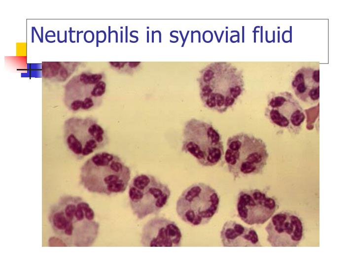 PPT - Synovial Fluid PowerPoint Presentation - ID:702385