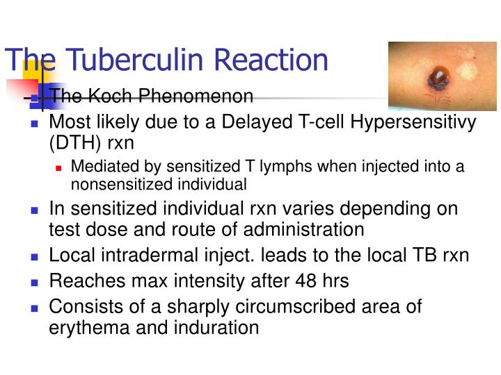 PPT - Mycobacteria: Tuberculosis and Leprosy PowerPoint Presentation ...