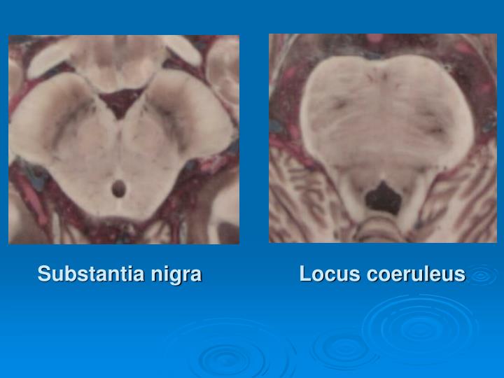 PPT - MRI of the locus coeruleus and substantia nigra PowerPoint ...