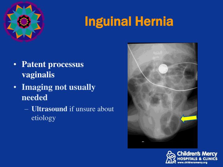 PPT - Lumps and Bumps PowerPoint Presentation - ID:705436