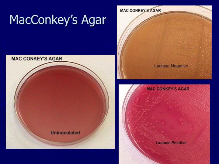 PPT - Diagnostic Medical Microbiology & Clinical Correlation PowerPoint ...