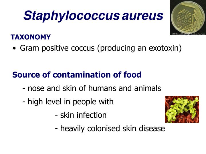 PPT - Foodborne Pathogen and Disease PowerPoint Presentation - ID:709614