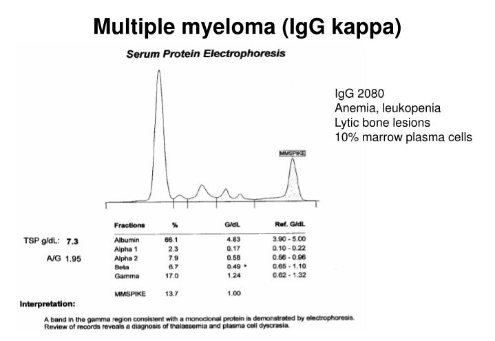 PPT - PLASMA CELL DYSCRASIAS PowerPoint Presentation - ID:710409