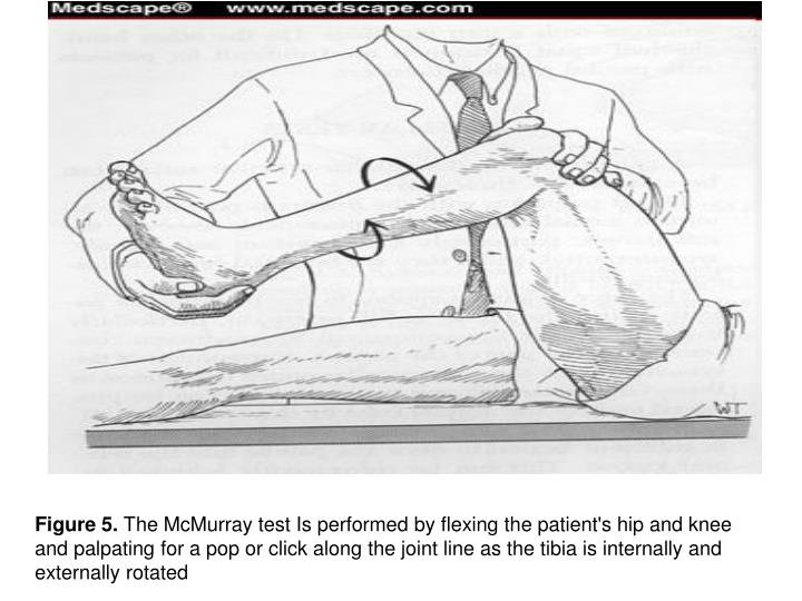 PPT - Medial meniscus injury PowerPoint Presentation - ID:710861