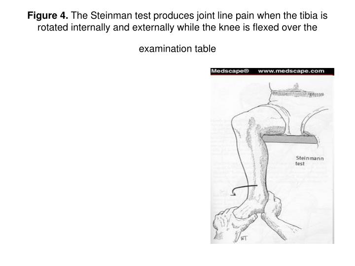 PPT - Medial meniscus injury PowerPoint Presentation - ID:710861