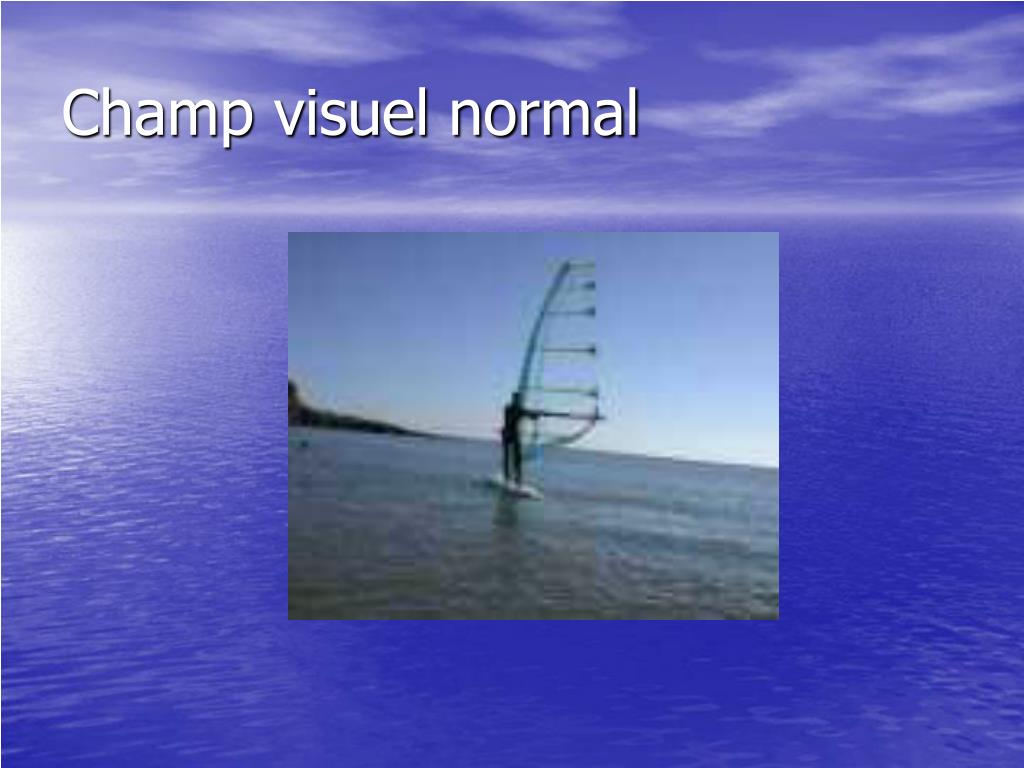 PPT - Examens complémentaires en ophtalmologie PowerPoint Presentation ...