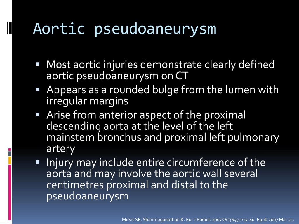 PPT - MDCT & MRI Pictorial Review of Blunt Traumatic Aortic Injury ...