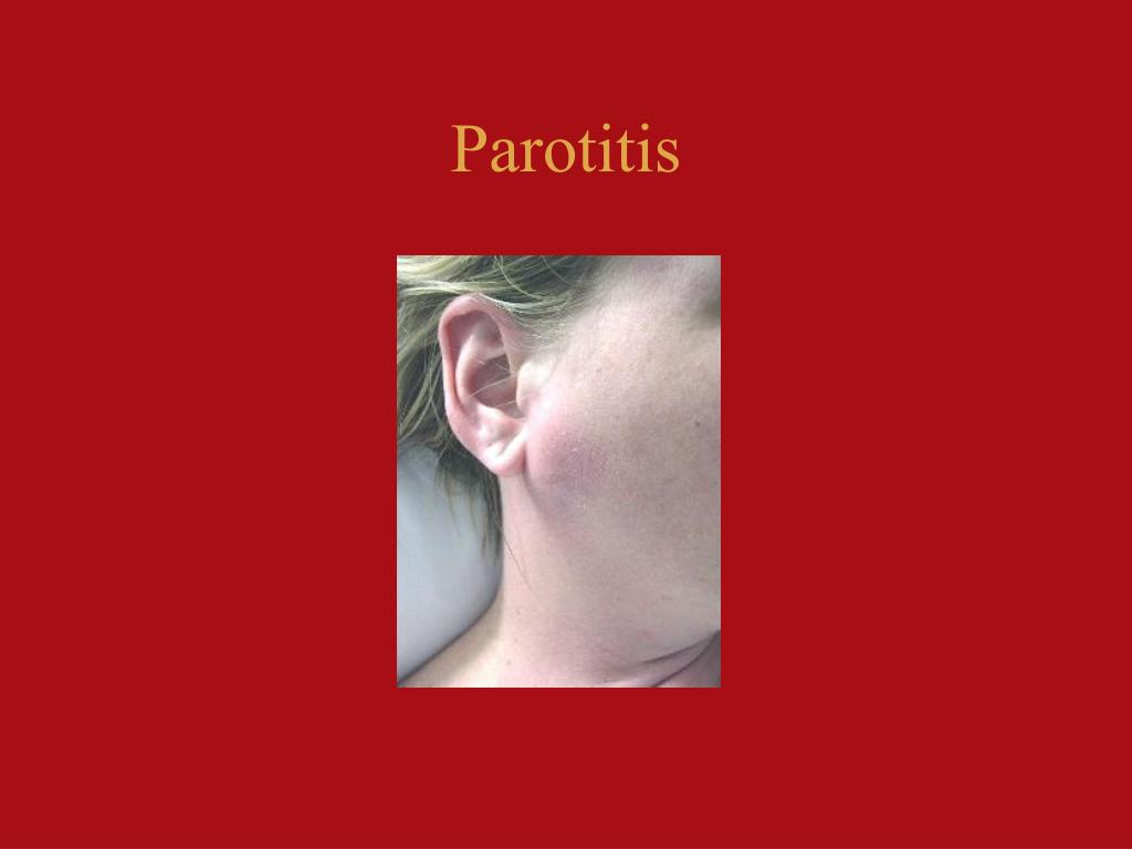 PPT - Physical Diagnosis in Otolaryngology Department of Otolaryngology ...