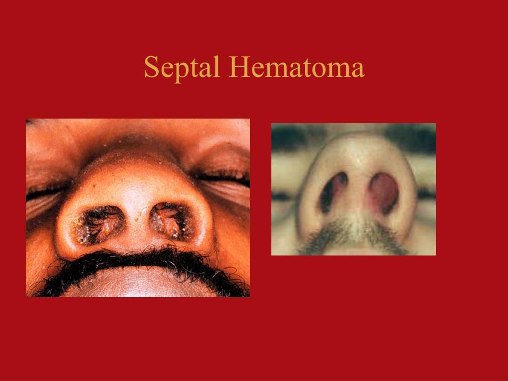 PPT - Physical Diagnosis in Otolaryngology Department of Otolaryngology ...