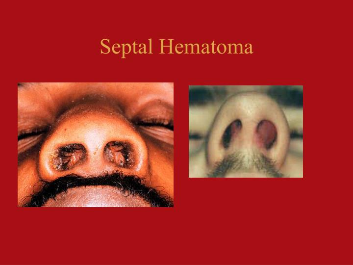 PPT - Physical Diagnosis in Otolaryngology Department of Otolaryngology ...