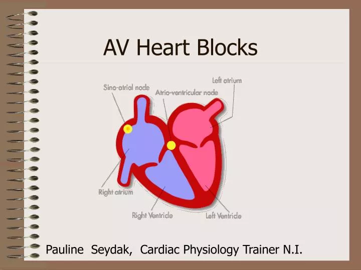 PPT - AV Heart Blocks PowerPoint Presentation, free download - ID:720555