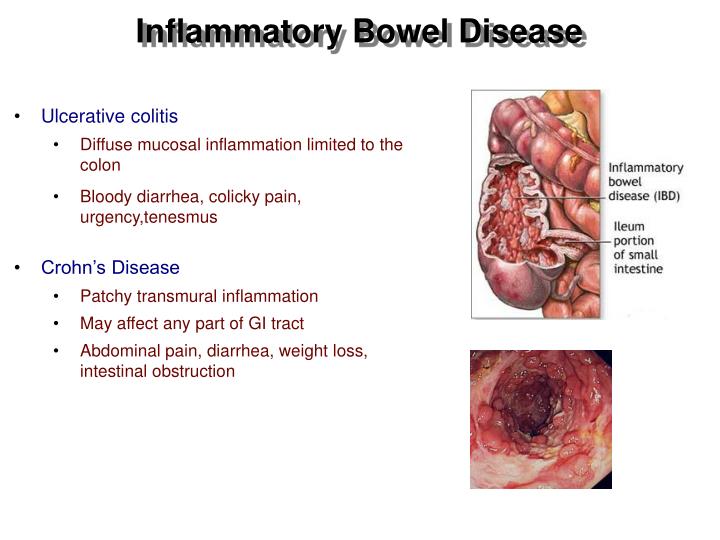 PPT - GASTROINTESTINAL PHARMACOLOGY PowerPoint Presentation - ID:723443