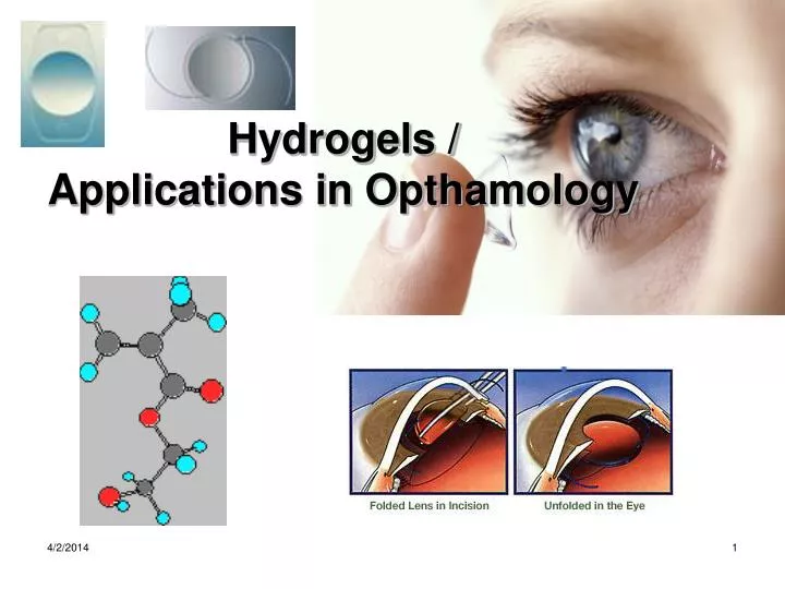 PPT - Hydrogels / Applications in Opthamology PowerPoint Presentation ...