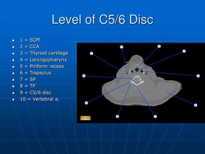 PPT - Cervical Spine PowerPoint Presentation - ID:732240