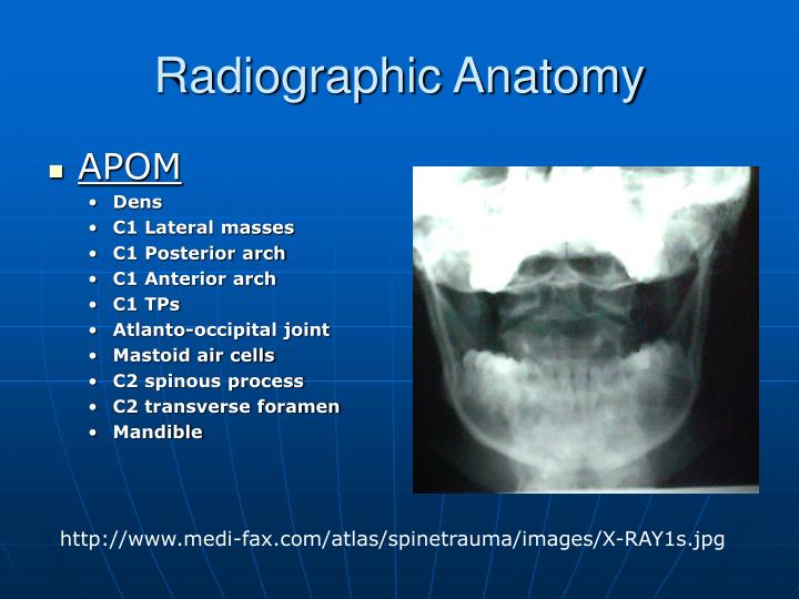 PPT - Cervical Spine PowerPoint Presentation - ID:732240