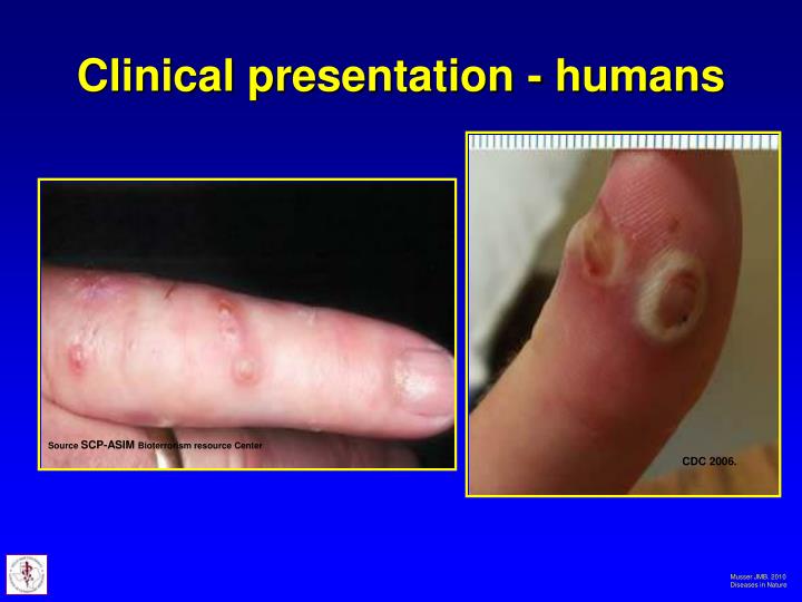 PPT - ORF: A Shared Vesicular Disease of Sheep, Goats, and Humans ...