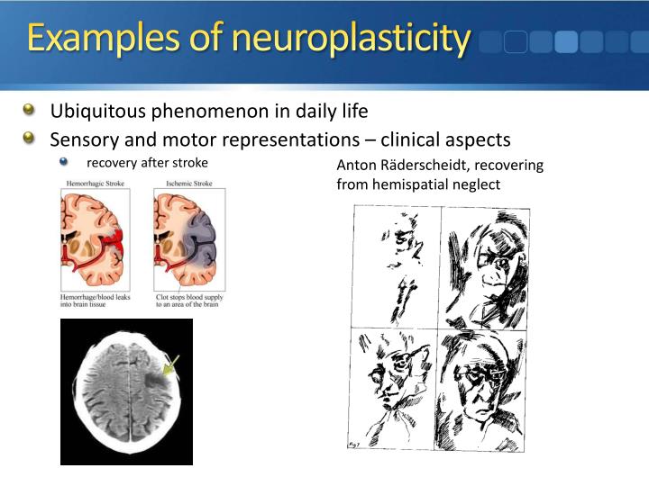 PPT - Measuring plasticity with MRI in humans PowerPoint Presentation ...