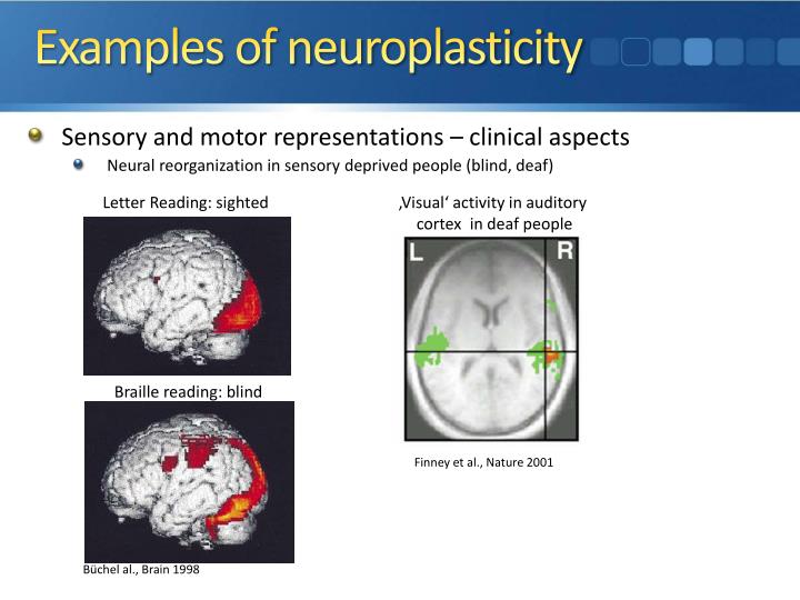 PPT - Measuring plasticity with MRI in humans PowerPoint Presentation ...
