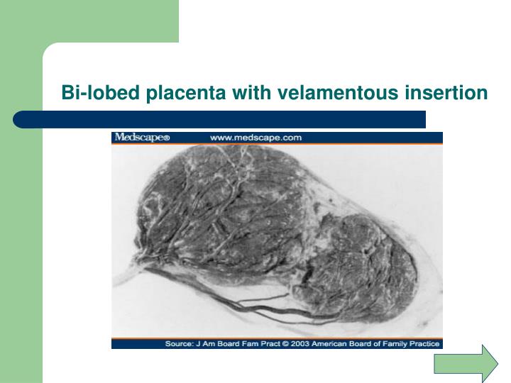PPT - Third Trimester Bleeding PowerPoint Presentation - ID:735364