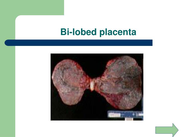 PPT - Third Trimester Bleeding PowerPoint Presentation - ID:735364