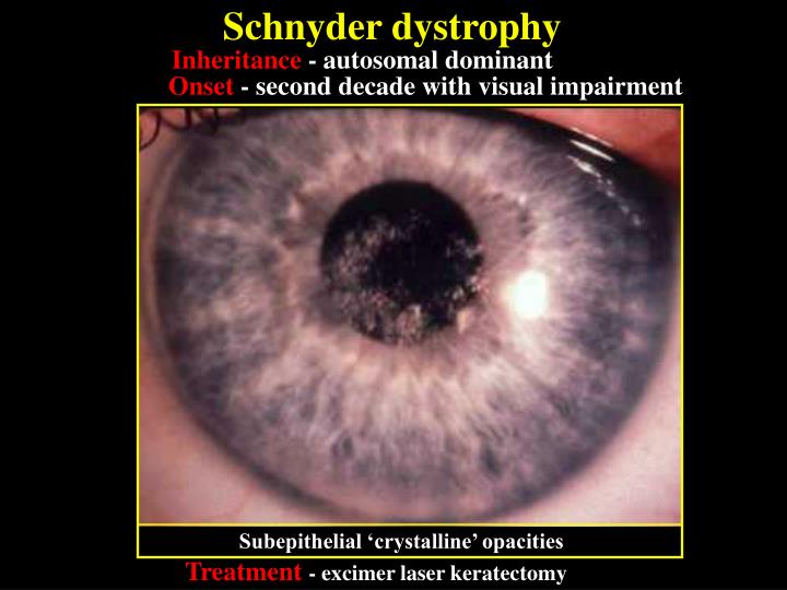 PPT - CORNEAL DYSTROPHIES PowerPoint Presentation - ID:735456