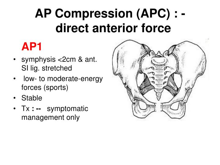 PPT - Pelvis fracture PowerPoint Presentation - ID:737949