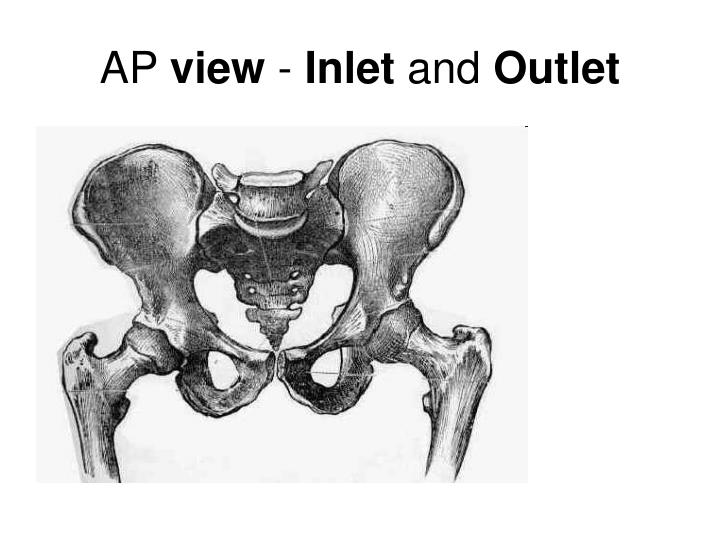 PPT - Pelvis fracture PowerPoint Presentation - ID:737949