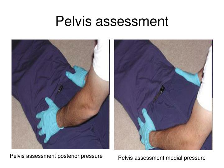 PPT - Pelvis fracture PowerPoint Presentation - ID:737949
