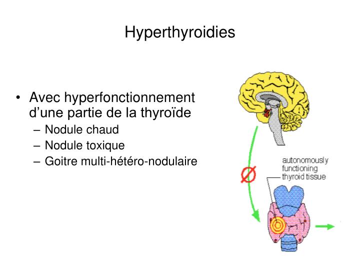 PPT - Infection et scintigraphie PowerPoint Presentation - ID:739848