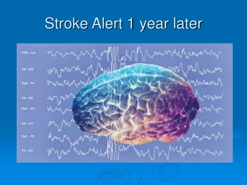 PPT - Stroke Alert at Lutheran General Hospital, Park Ridge, IL ...