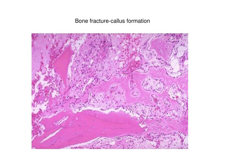 PPT - Bone Diseases by: Dr.Asmaa Najim FICMS/Histopathology Lecturer ...