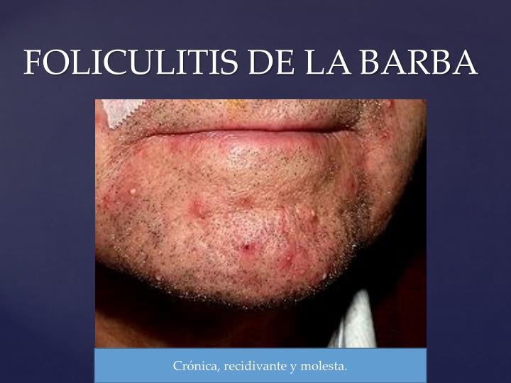PPT - DERMATOLOGÍA PowerPoint Presentation - ID:742046