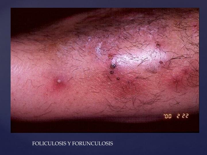 PPT - DERMATOLOGÍA PowerPoint Presentation - ID:742046
