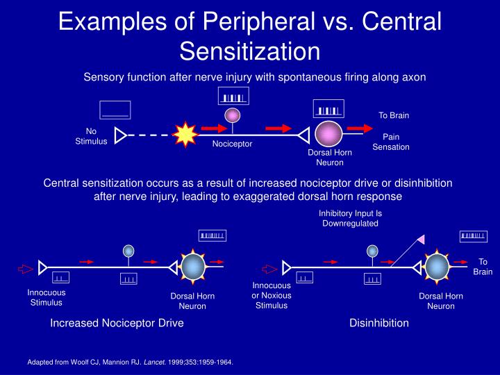 PPT - Pathophysiology of Acute & Chronic Pain PowerPoint Presentation ...