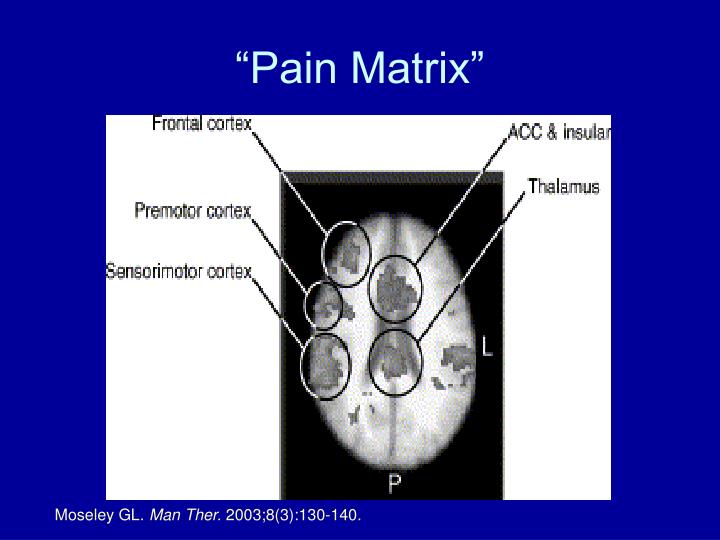 PPT - Pathophysiology of Acute & Chronic Pain PowerPoint Presentation ...