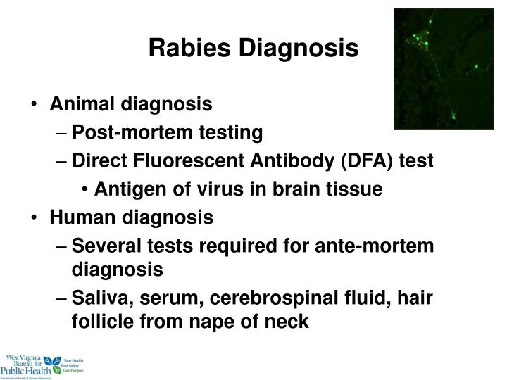 PPT - Biology and Epidemiology of the Rabies Virus PowerPoint ...