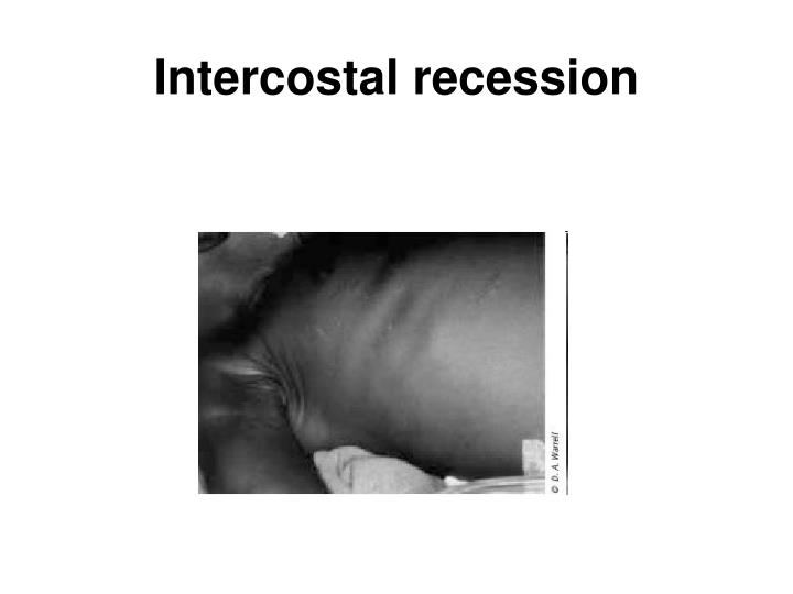 PPT - Respiratory disorders PowerPoint Presentation - ID:745595