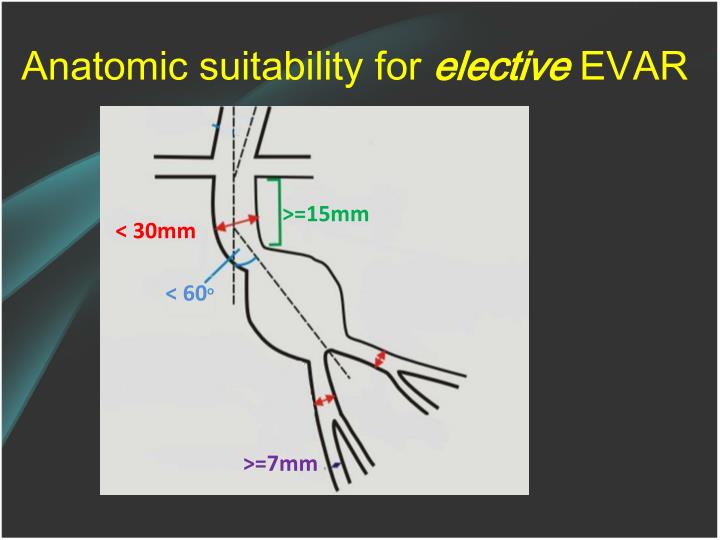 PPT - Rupture AAA – Any NEW advances? PowerPoint Presentation - ID:755014